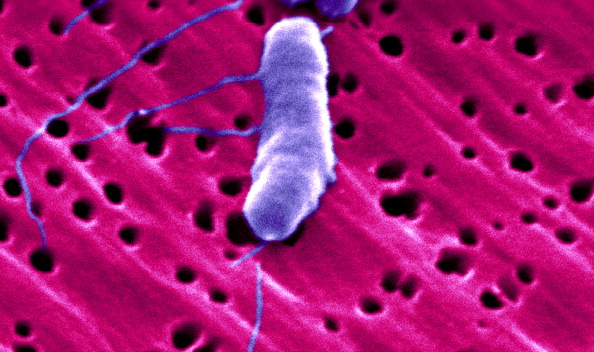 Man gets flesh-eating bacteria at Va. Beach | wcnc.com