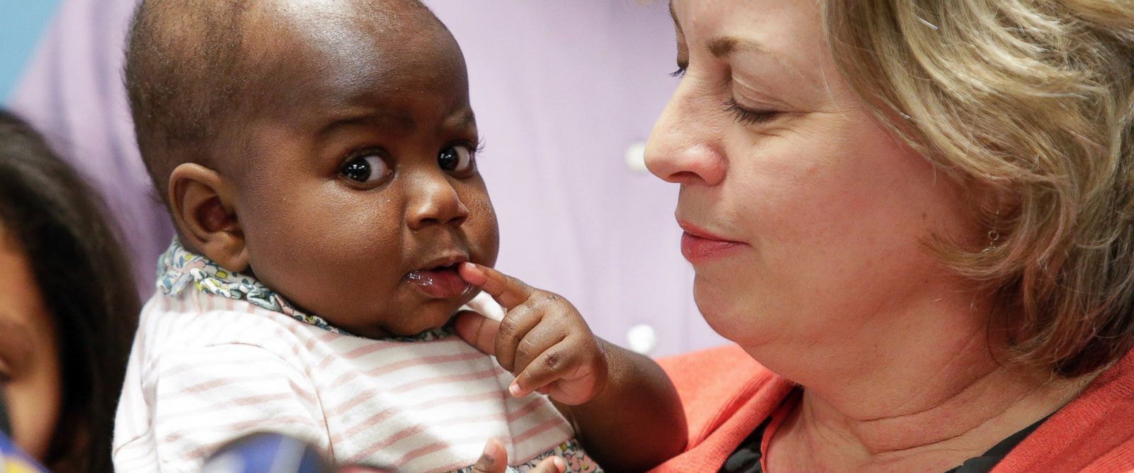 Baby born with extra legs thriving after surgery | 13newsnow.com